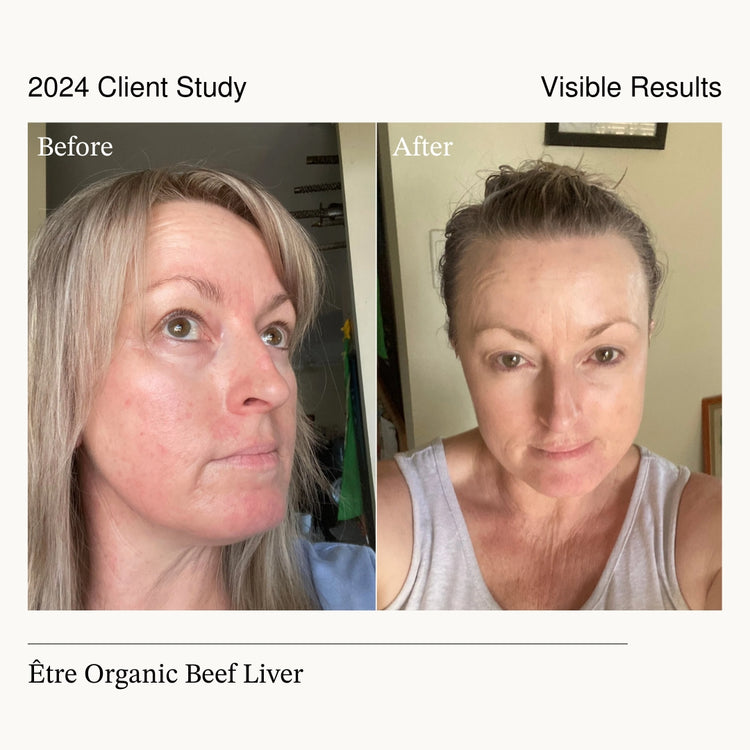 Etre Health | Pure Natural Supplements